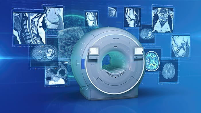 Innovando en la salud significativamente | Philips Cuidado de la Salud